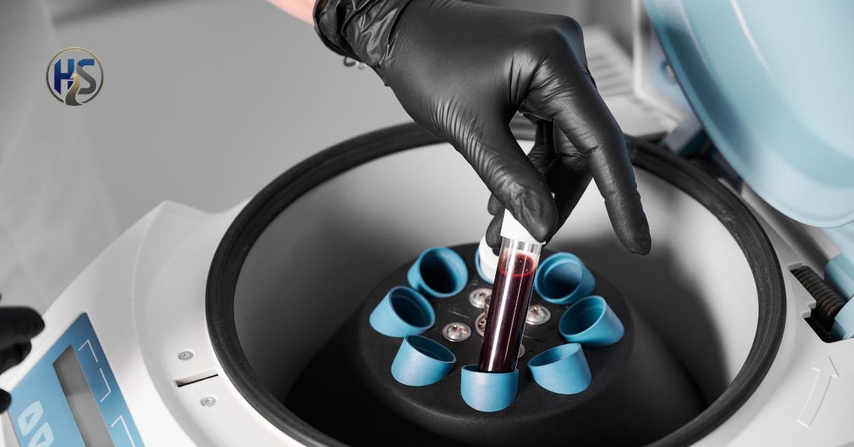 Blood Analysis MCHC: Hidden Secrets Your Test Isn’t Revealing